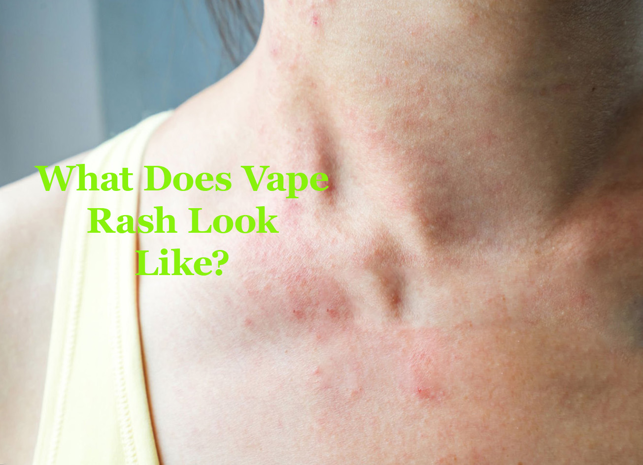 What Does Vape Rash Look Like? | lookah
